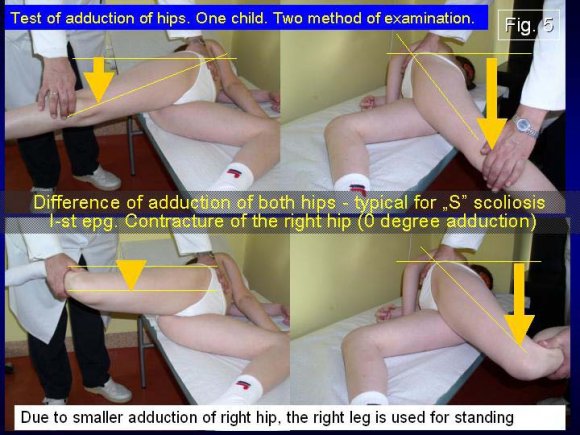 standing hip flexion test