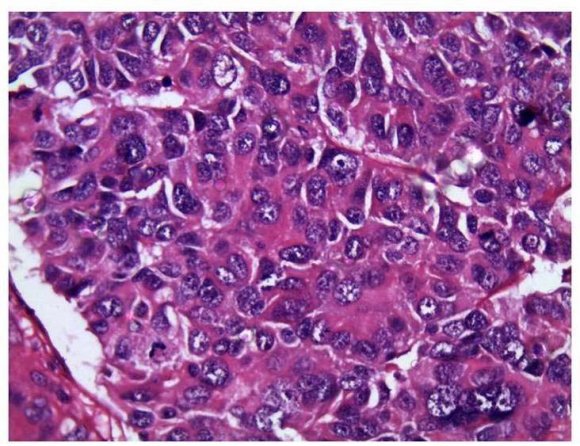 Entamoeba Coli as a Potent Phagocytic Microorganism