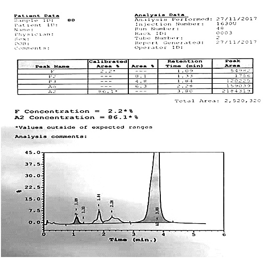 Hemoglobin EE Disease: A Case Report