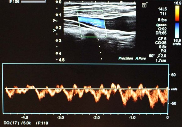 Ultrasound-Guided Central Venous Catheterization. Study Guide