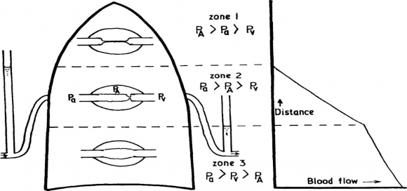 The Assessment of Prone Position in Severe Acute Respiratory Syndrome